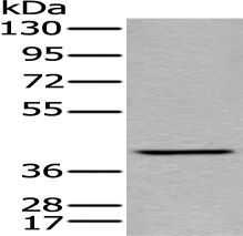 【Anti-COL3A1 antibody】_上海酶联生物
