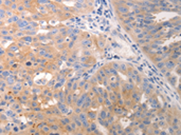 【兔抗KRT6A/KRT6B/KRT6C多克隆抗体 】_上海酶联生物