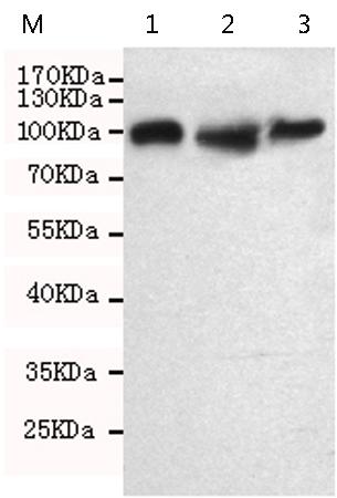 【小鼠抗HK2单克隆抗体 】_上海酶联生物