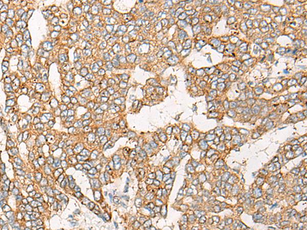 【兔抗CHKB-CPT1B多克隆抗体 】_上海酶联生物