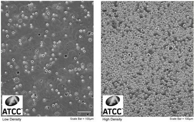 【永生化小鼠骨髓巨噬细胞；iBMDM】_上海酶联生物